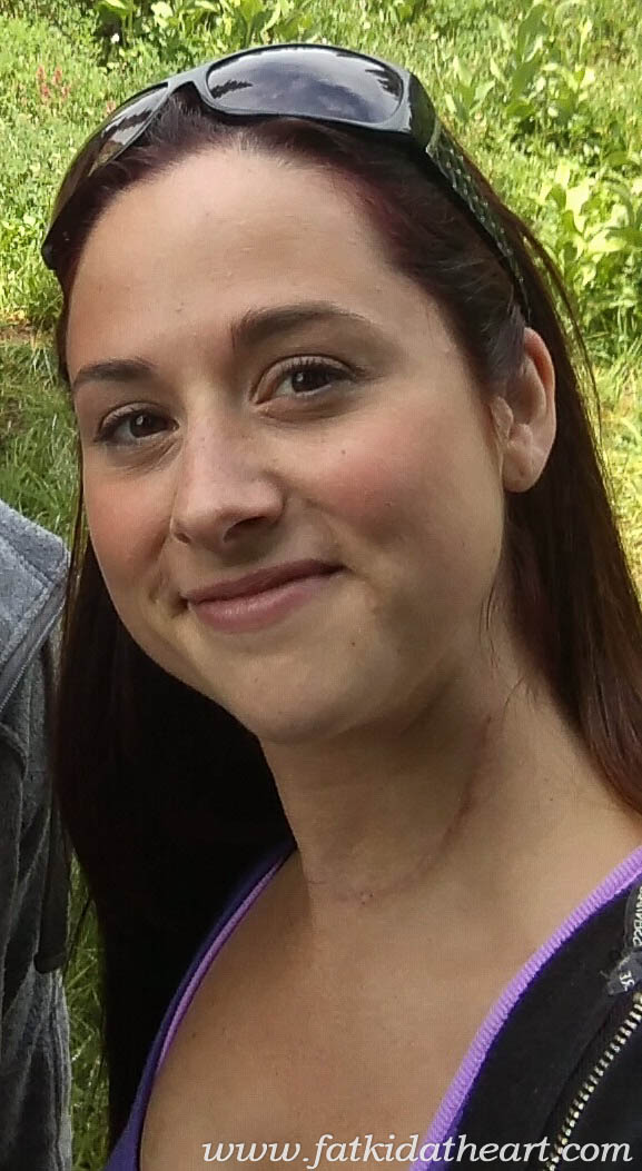 Let’s talk about the Scar
